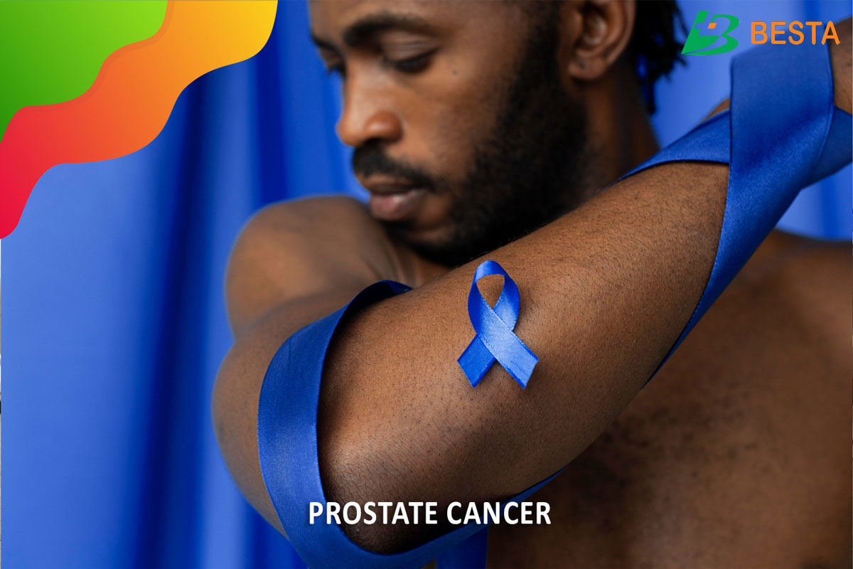 Prostate Cancer: Symptoms, Screening, and Treatment at Besta Polyclinic ...