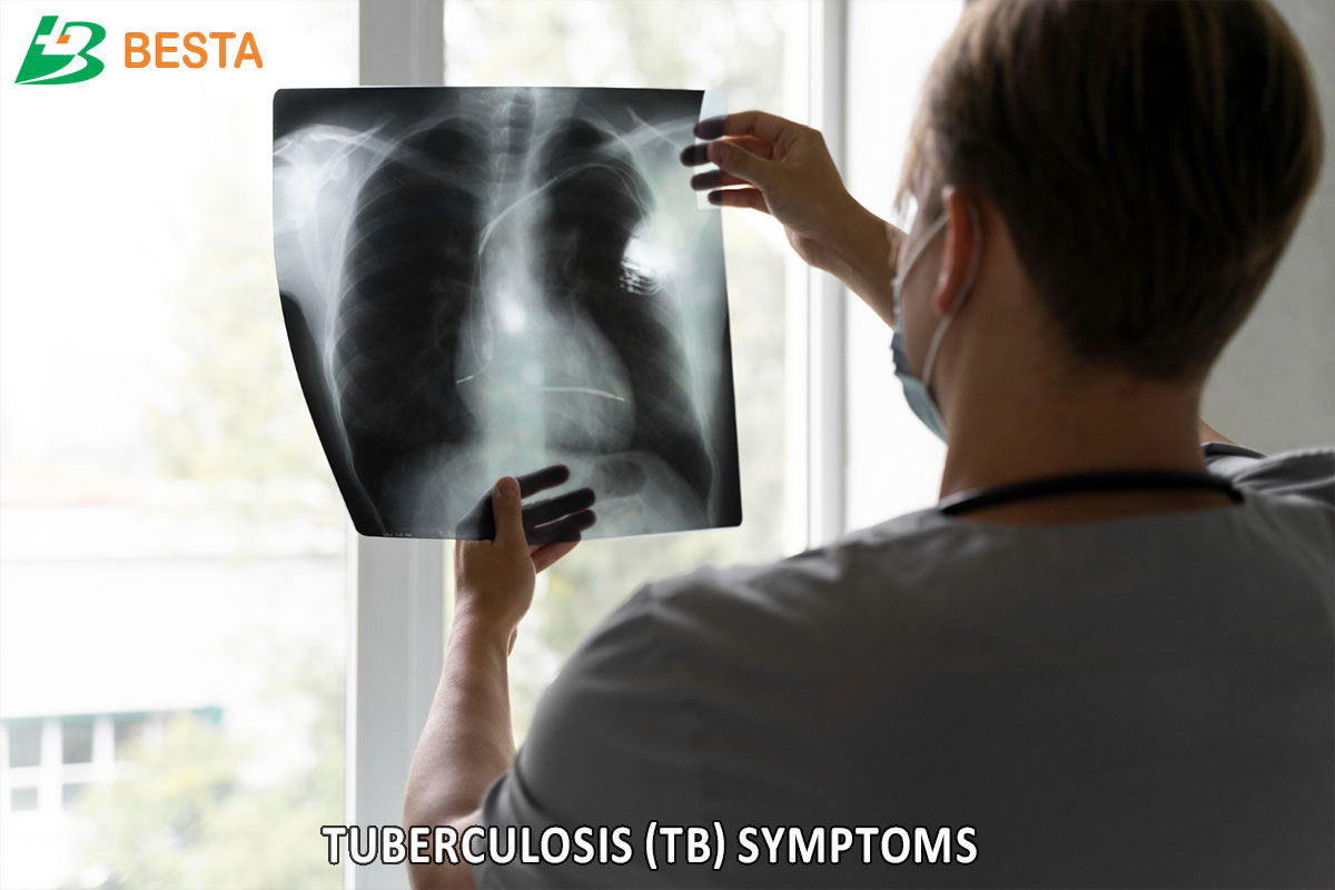 Tuberculosis Symptoms: 6 Silent Signs You Should Watch For - Besta